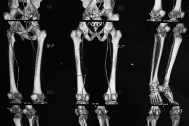 Council on Peripheral Vascular Disease (PVD) - Professional Heart Daily ...