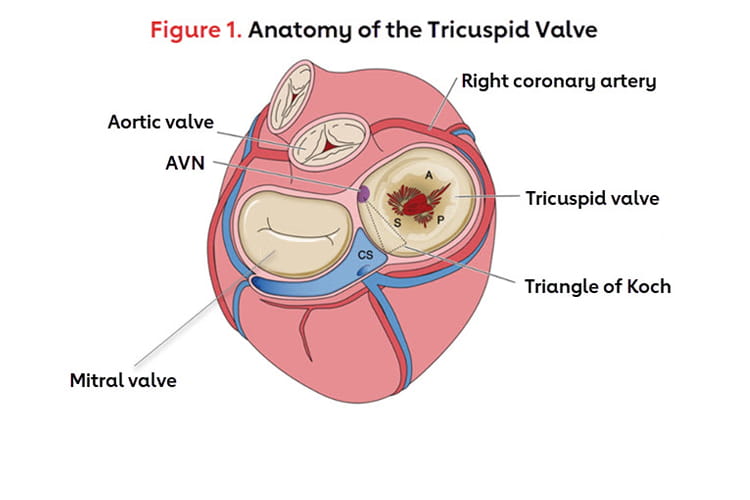 The Tricuspid Valve: A Review of Pathology, Imaging, and Current ...