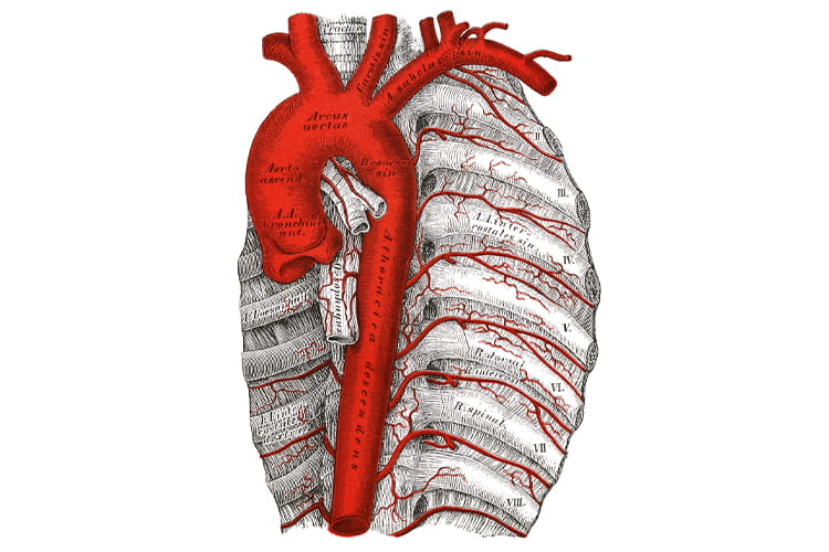 Cardiovascular Management of Aortopathy in Children - Professional ...