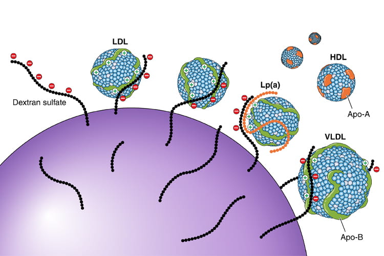 Lipoprotein Apheresis: Utility, Outcomes, and Implementation in ...