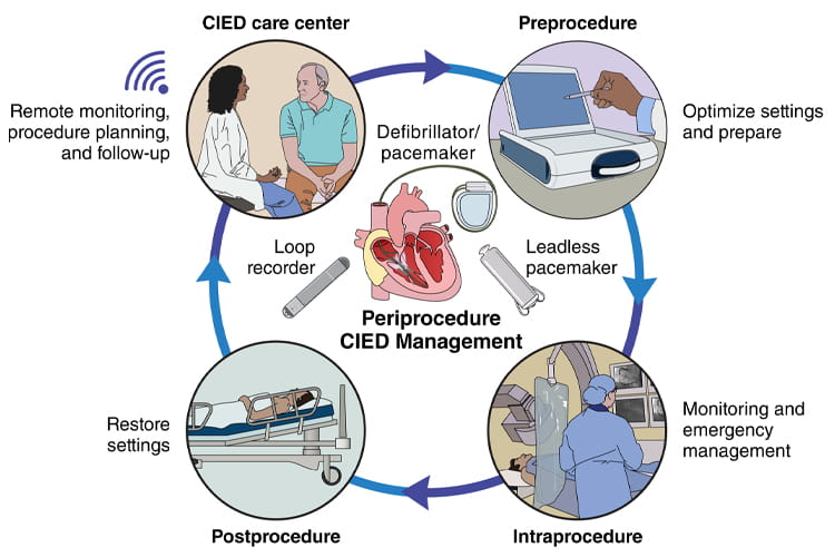 Periprocedural Management and Multidisciplinary Care Pathways for ...